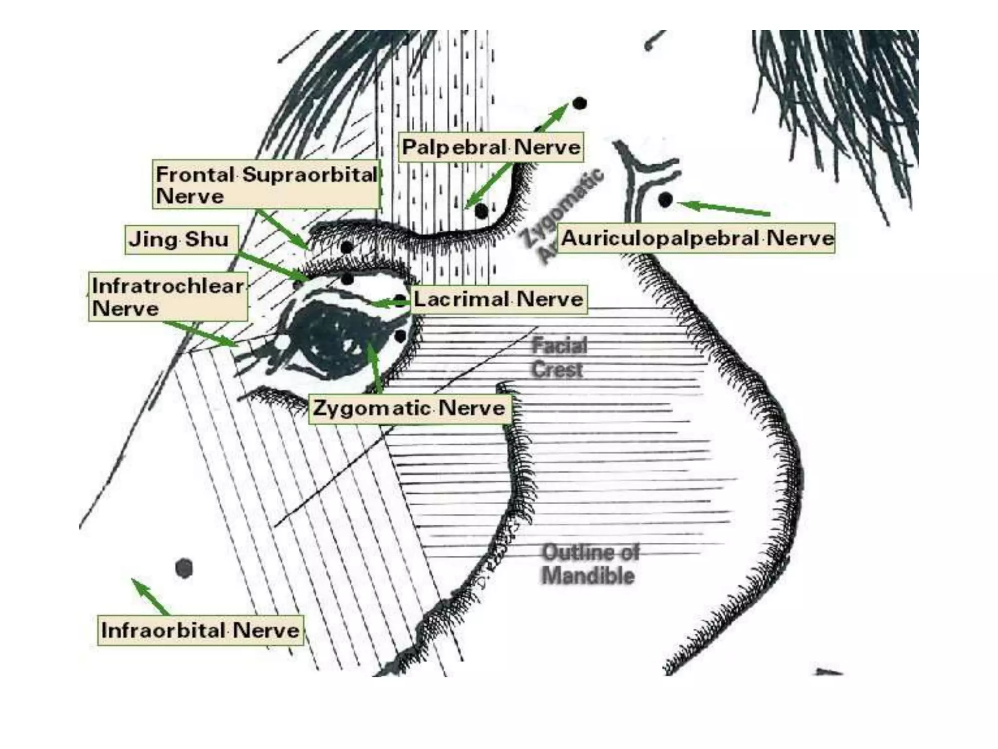 NERVE BLOCK IN EQUINE HEAD | PPTX