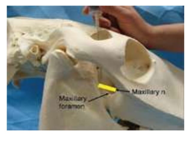 NERVE BLOCK IN EQUINE HEAD | PPTX