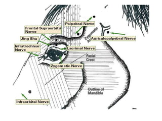NERVE BLOCK IN EQUINE HEAD | PPTX