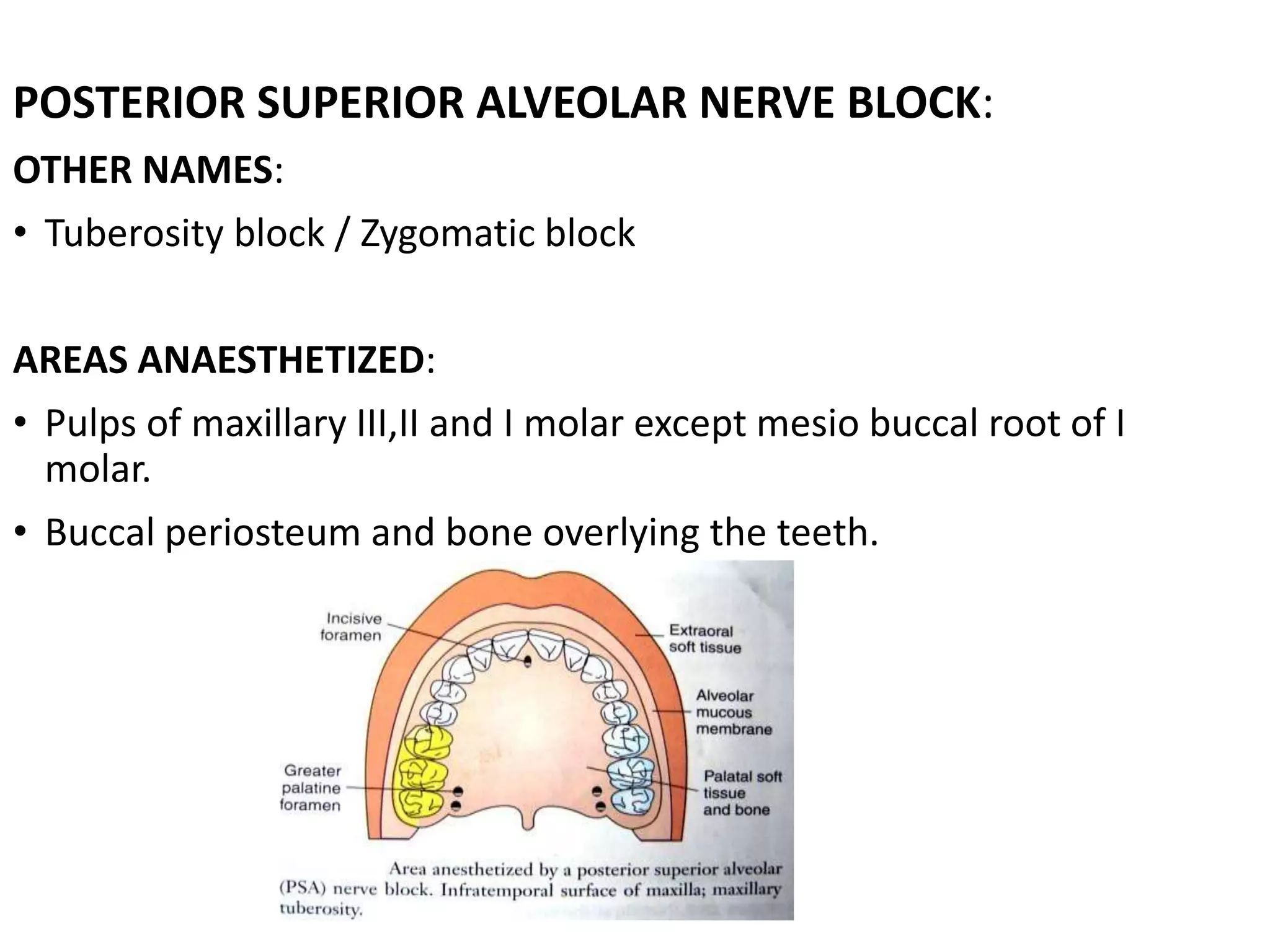Nerve blocks | PPT