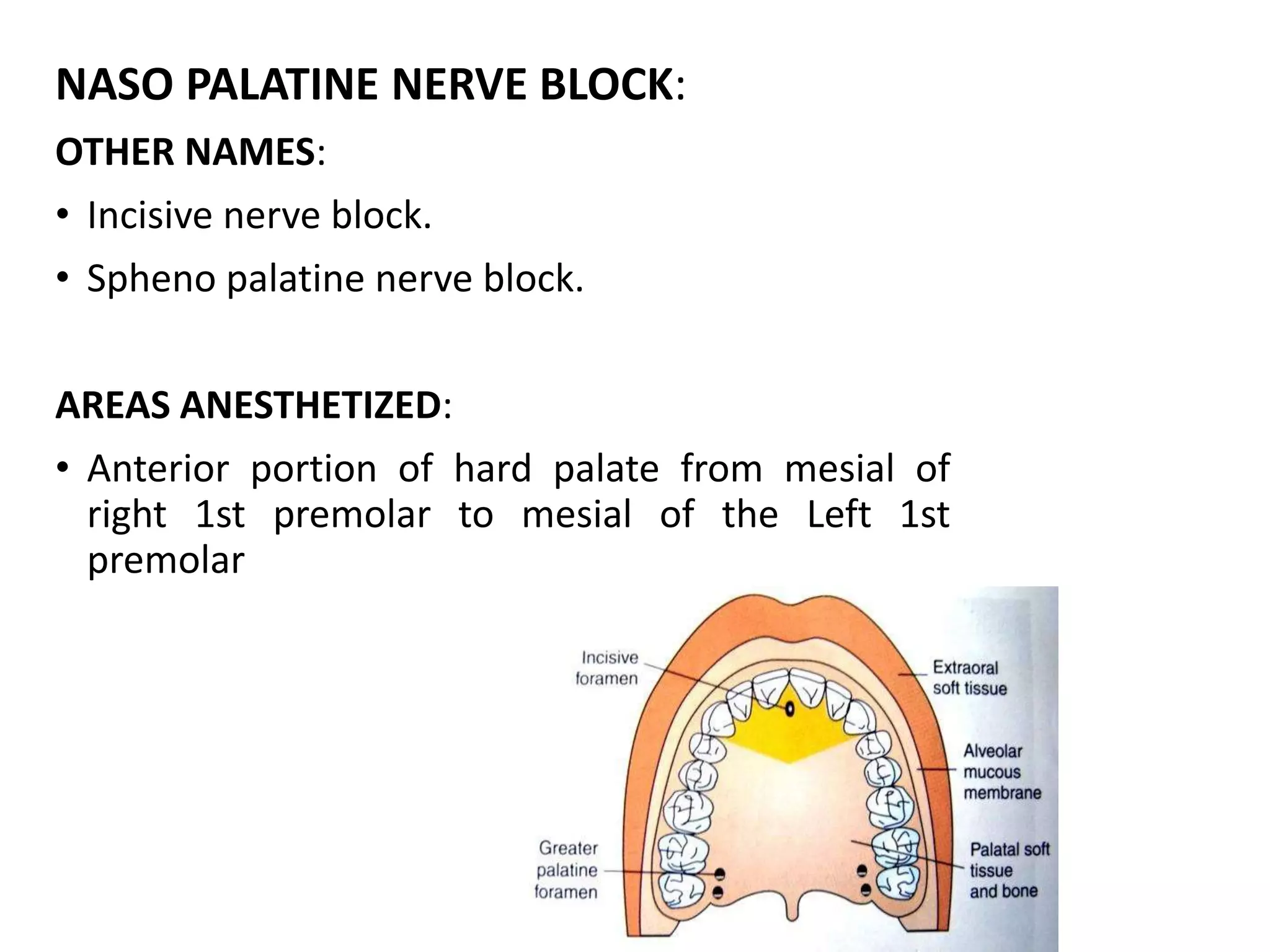 Nerve blocks | PPT
