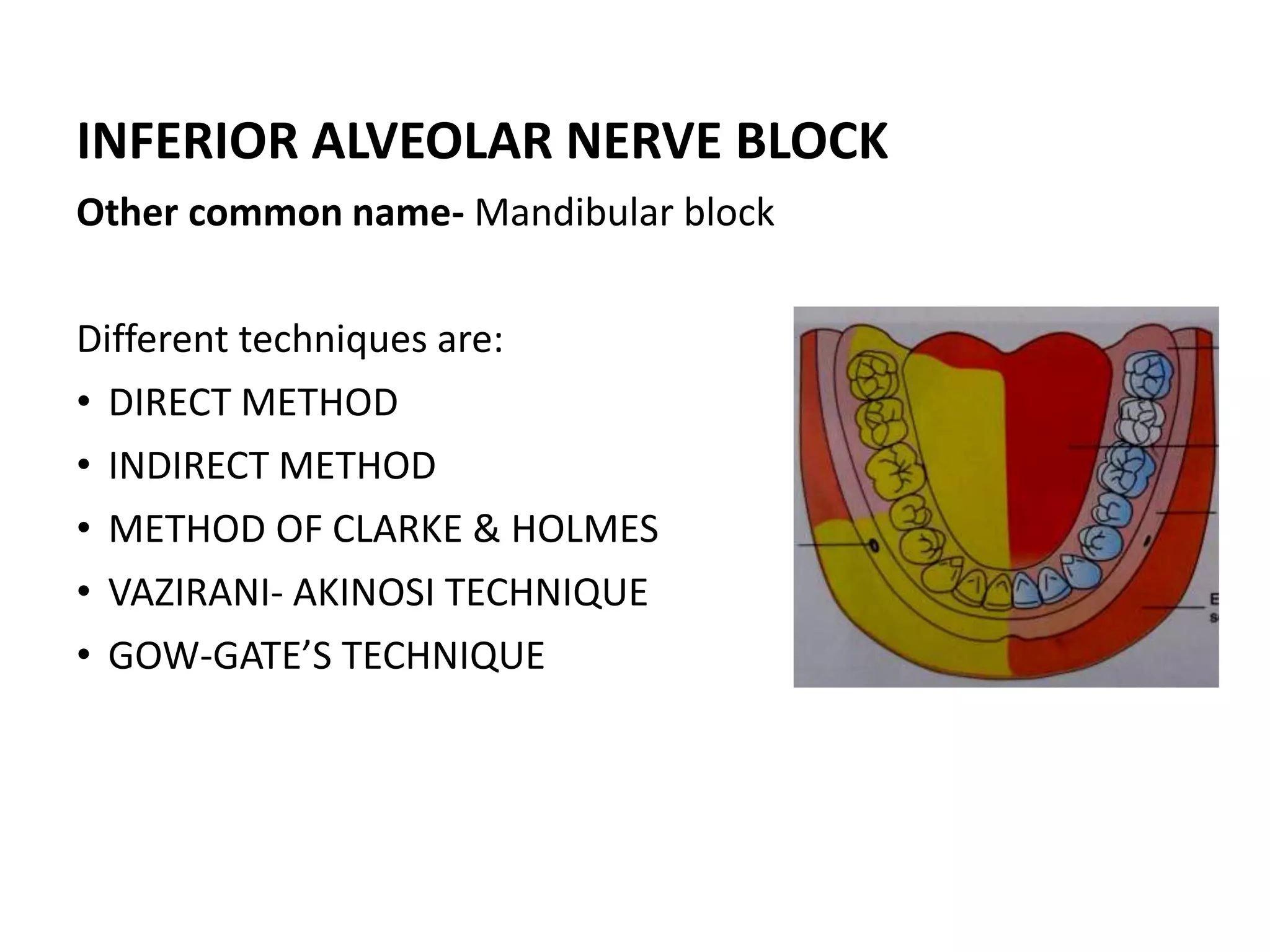 Nerve blocks | PPT