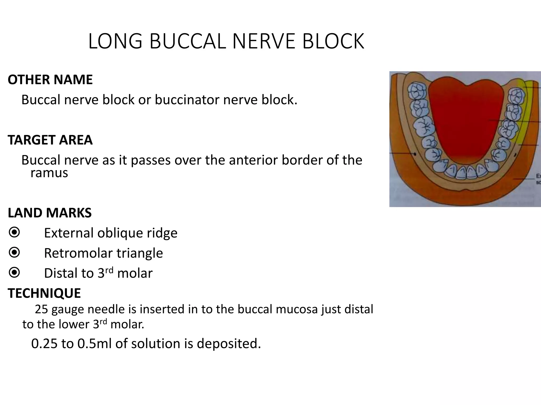 Nerve blocks | PPT