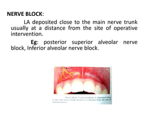 Ear Nerve Field Block