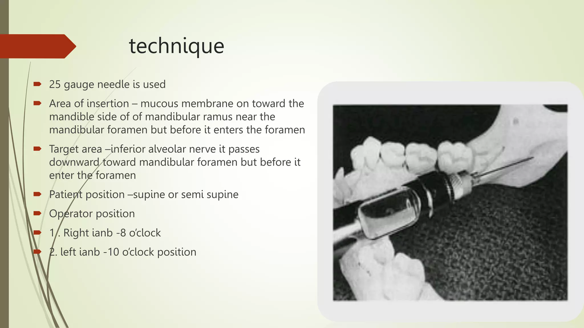 NERVE BLOCKS AND ANATOMICAL LANDMARKS IN PEDIATRIC DENTISTRY.pptx