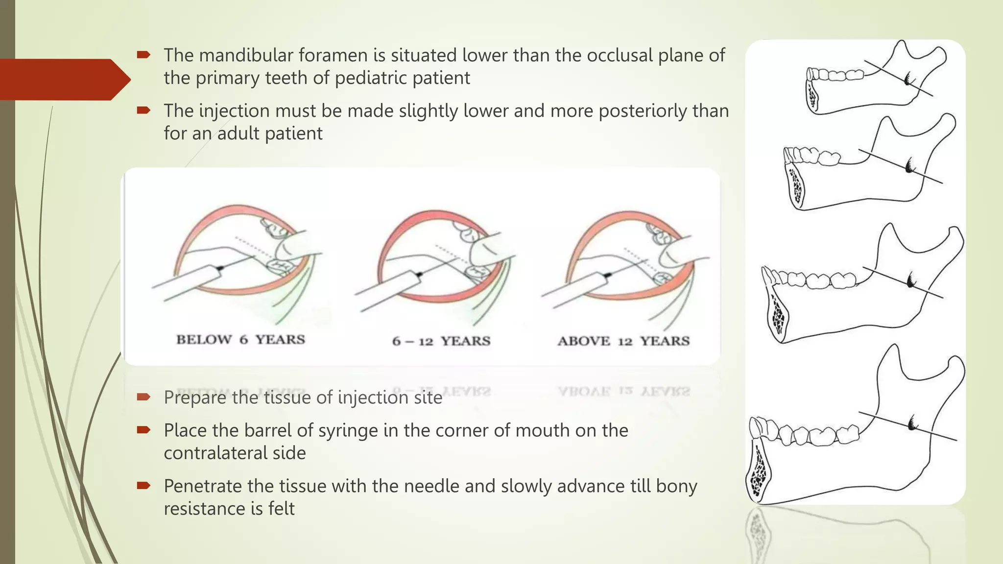 NERVE BLOCKS AND ANATOMICAL LANDMARKS IN PEDIATRIC DENTISTRY.pptx