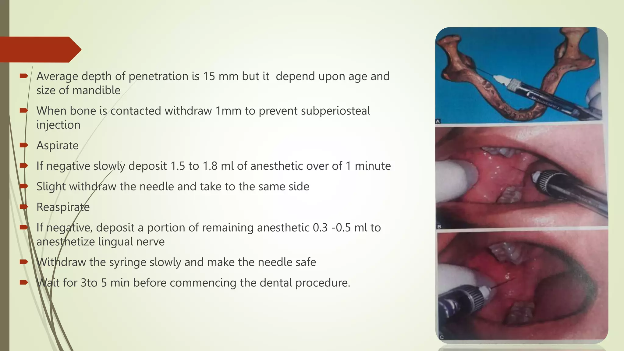 NERVE BLOCKS AND ANATOMICAL LANDMARKS IN PEDIATRIC DENTISTRY.pptx