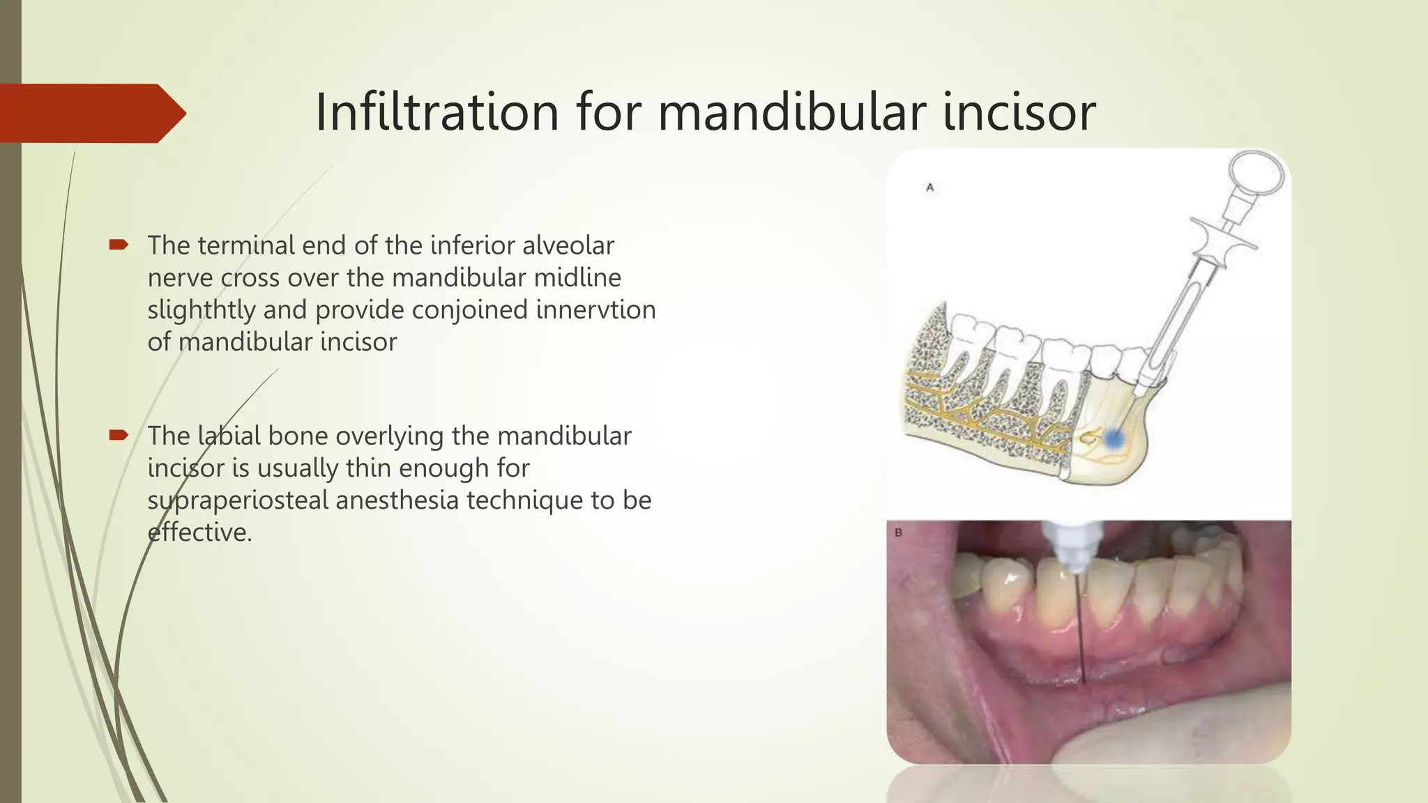 NERVE BLOCKS AND ANATOMICAL LANDMARKS IN PEDIATRIC DENTISTRY.pptx