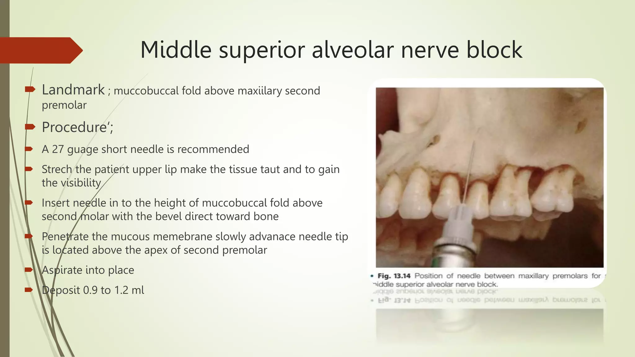 NERVE BLOCKS AND ANATOMICAL LANDMARKS IN PEDIATRIC DENTISTRY.pptx