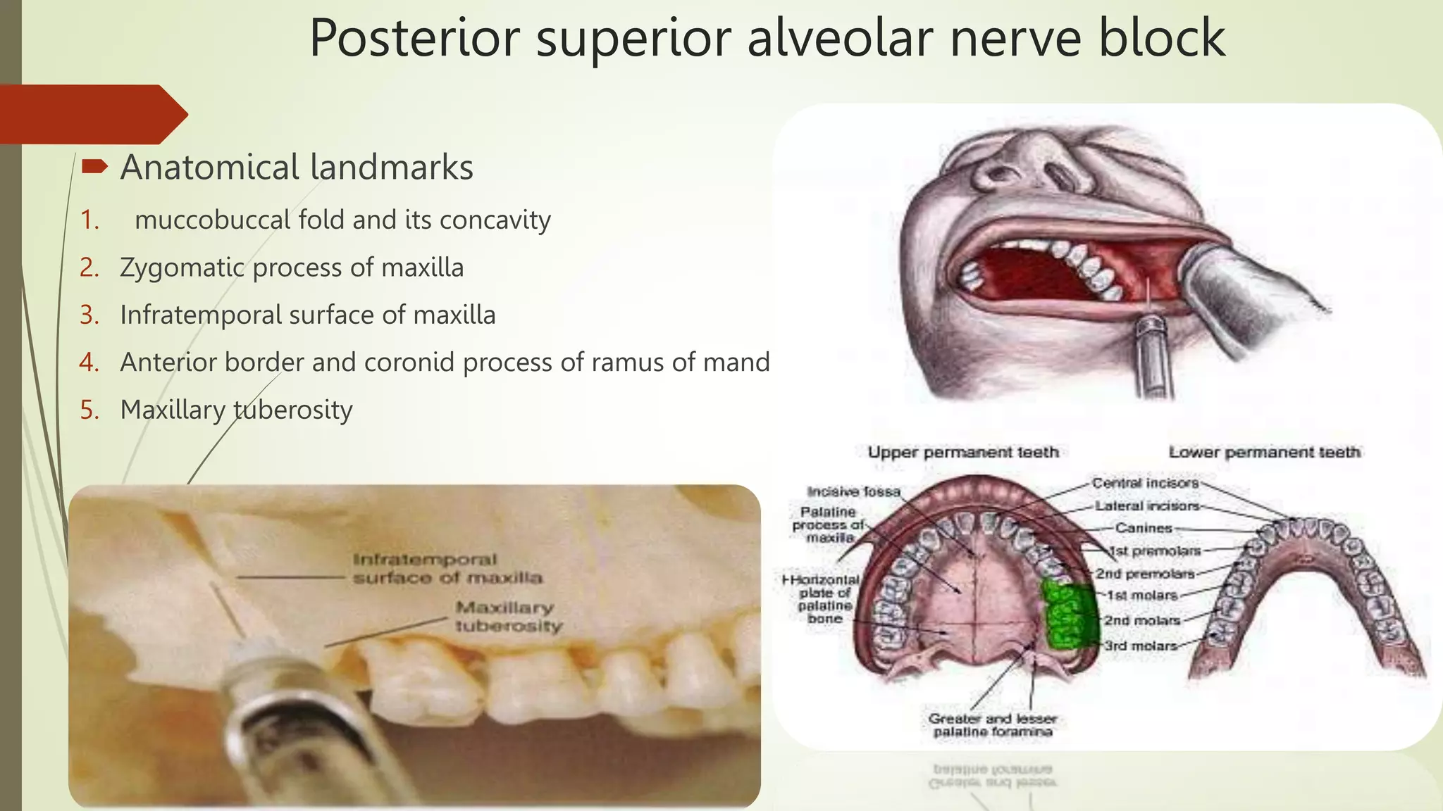 NERVE BLOCKS AND ANATOMICAL LANDMARKS IN PEDIATRIC DENTISTRY.pptx