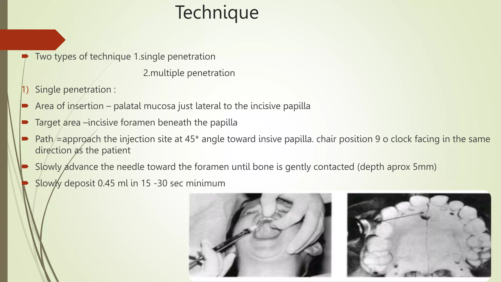 NERVE BLOCKS AND ANATOMICAL LANDMARKS IN PEDIATRIC DENTISTRY.pptx