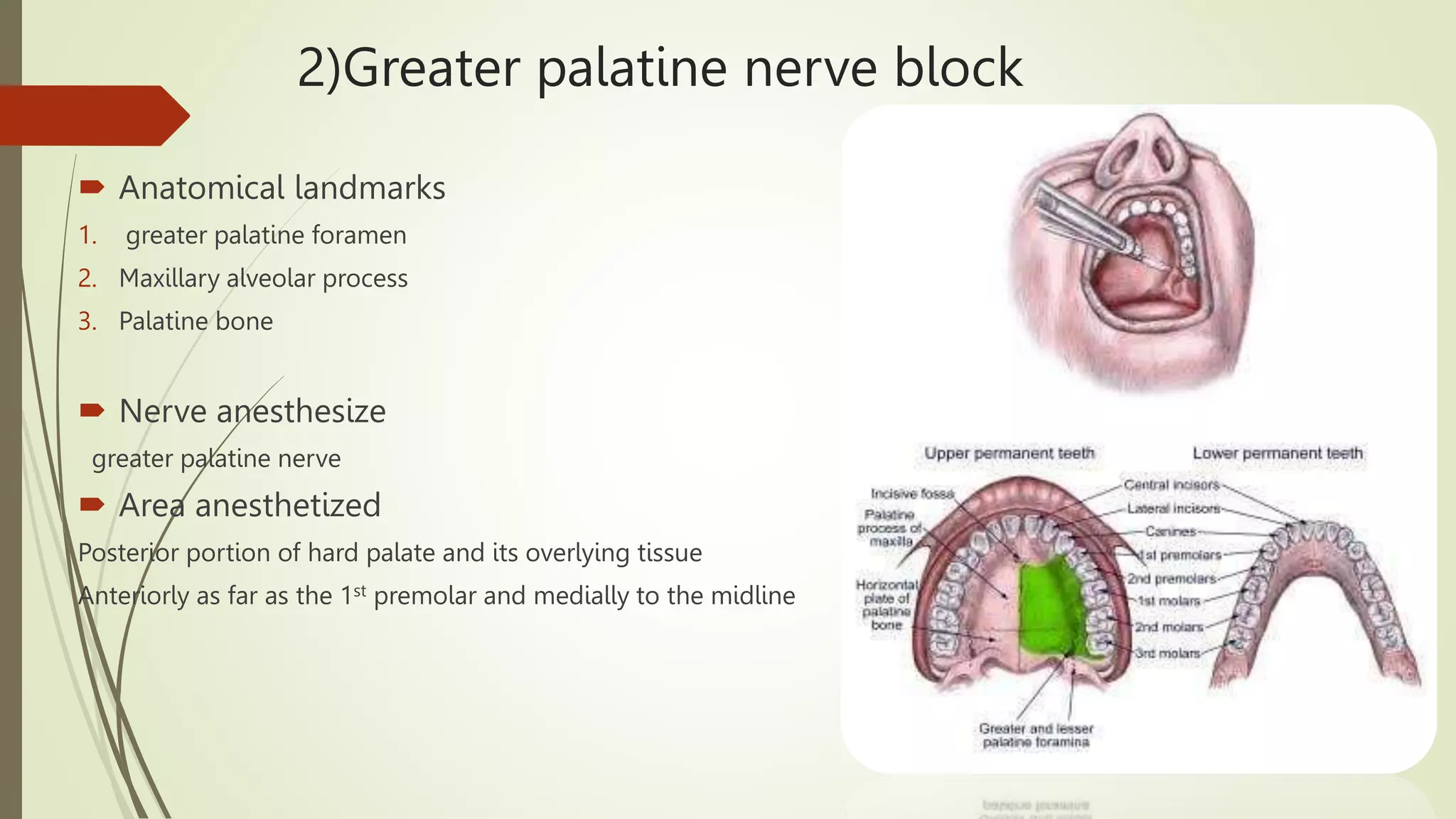 NERVE BLOCKS AND ANATOMICAL LANDMARKS IN PEDIATRIC DENTISTRY.pptx