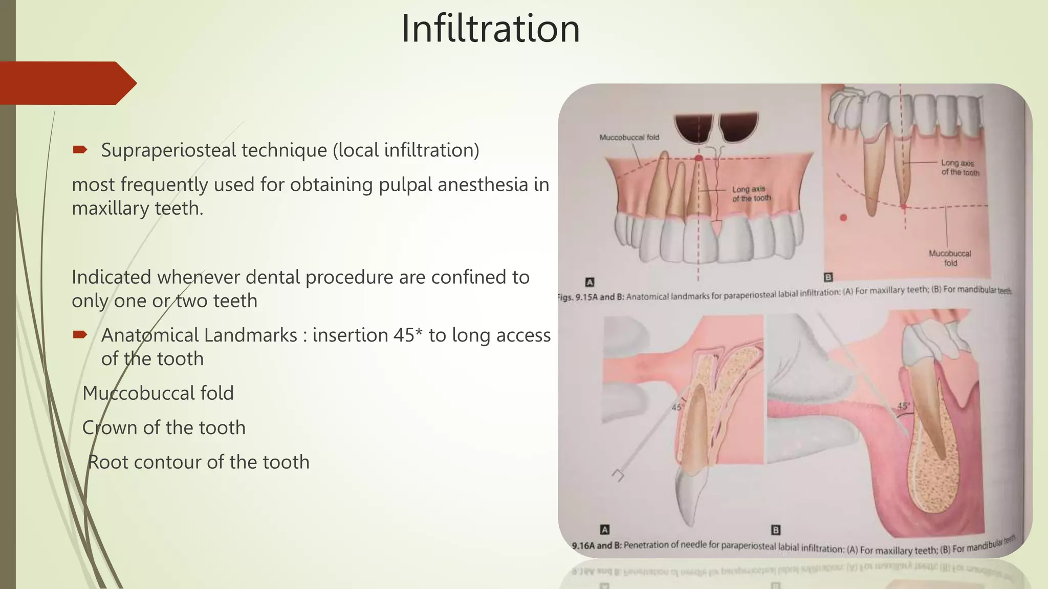 NERVE BLOCKS AND ANATOMICAL LANDMARKS IN PEDIATRIC DENTISTRY.pptx