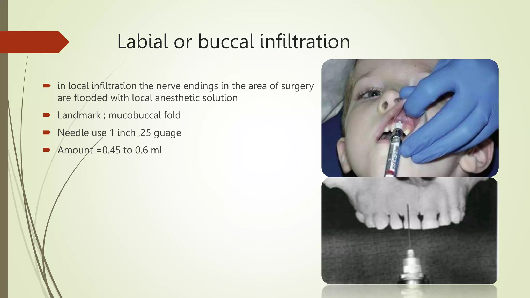 NERVE BLOCKS AND ANATOMICAL LANDMARKS IN PEDIATRIC DENTISTRY.pptx