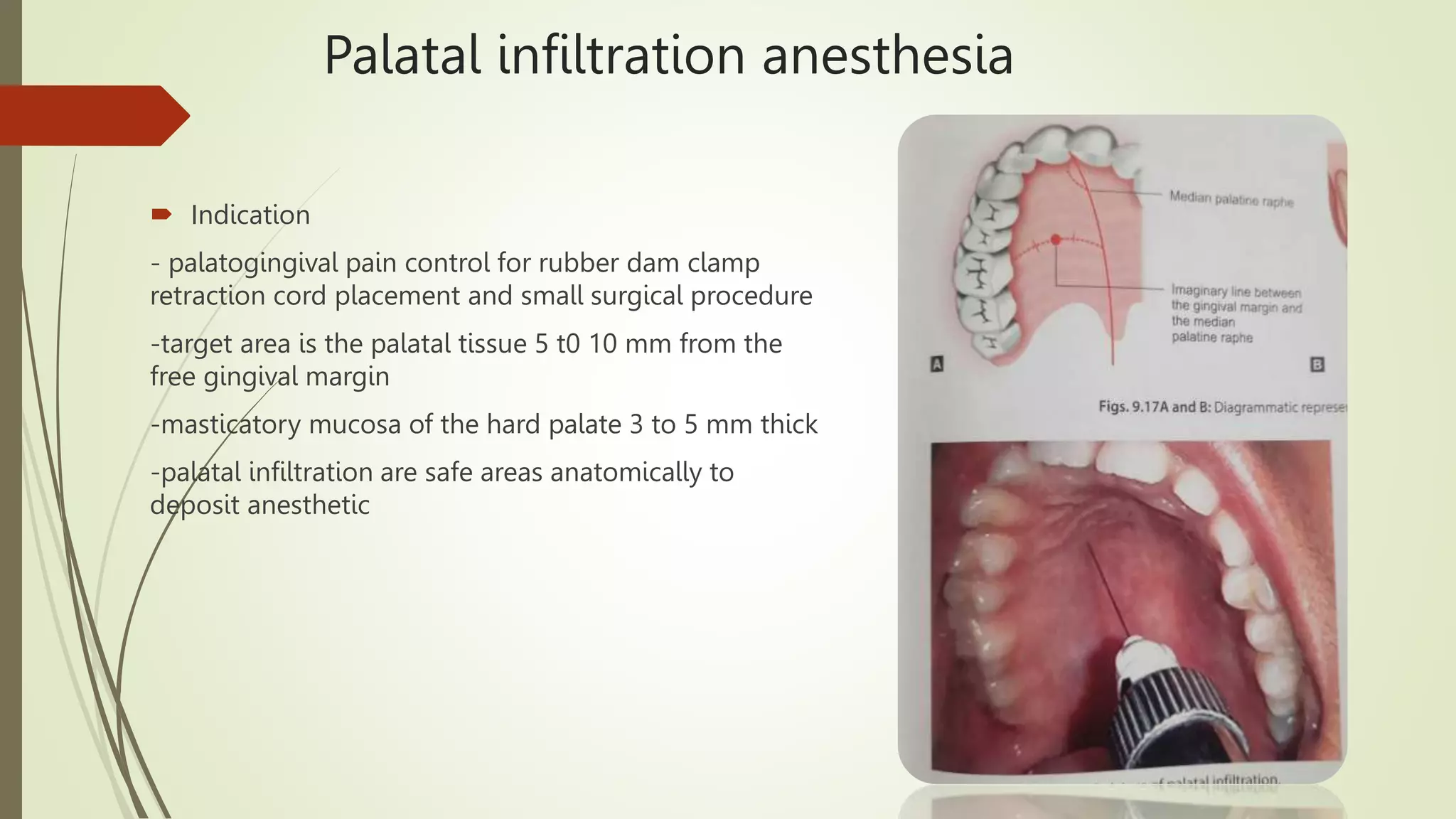 NERVE BLOCKS AND ANATOMICAL LANDMARKS IN PEDIATRIC DENTISTRY.pptx