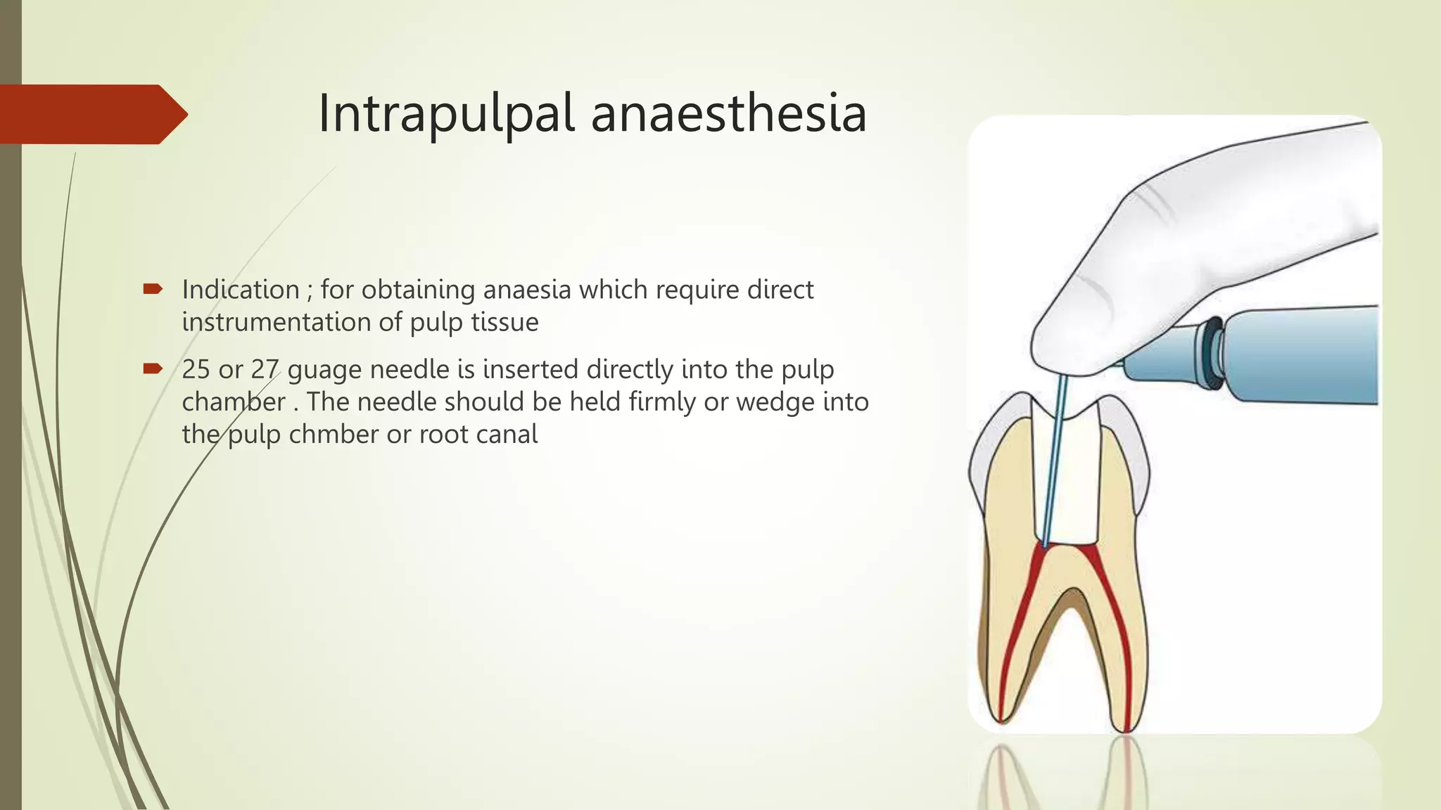 NERVE BLOCKS AND ANATOMICAL LANDMARKS IN PEDIATRIC DENTISTRY.pptx