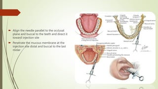 NERVE BLOCKS AND ANATOMICAL LANDMARKS IN PEDIATRIC DENTISTRY.pptx