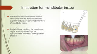 NERVE BLOCKS AND ANATOMICAL LANDMARKS IN PEDIATRIC DENTISTRY.pptx