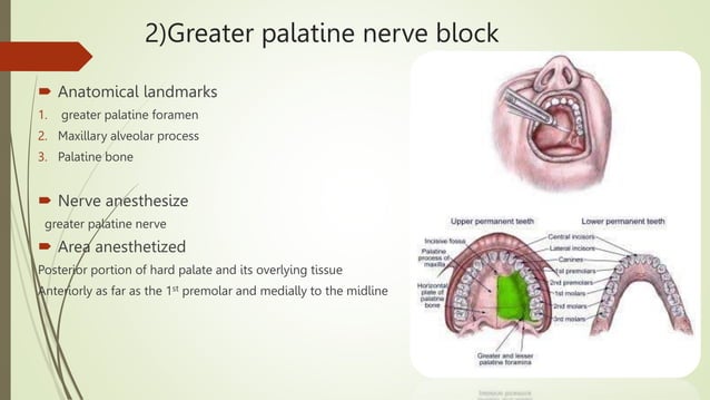 NERVE BLOCKS AND ANATOMICAL LANDMARKS IN PEDIATRIC DENTISTRY.pptx
