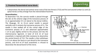 Intercostal Nerve Block Canine