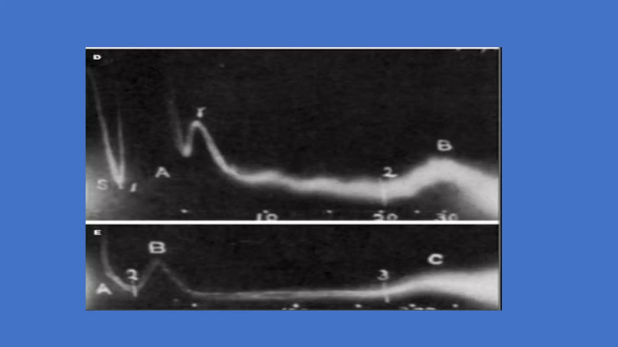 Nerve Classification Pptx