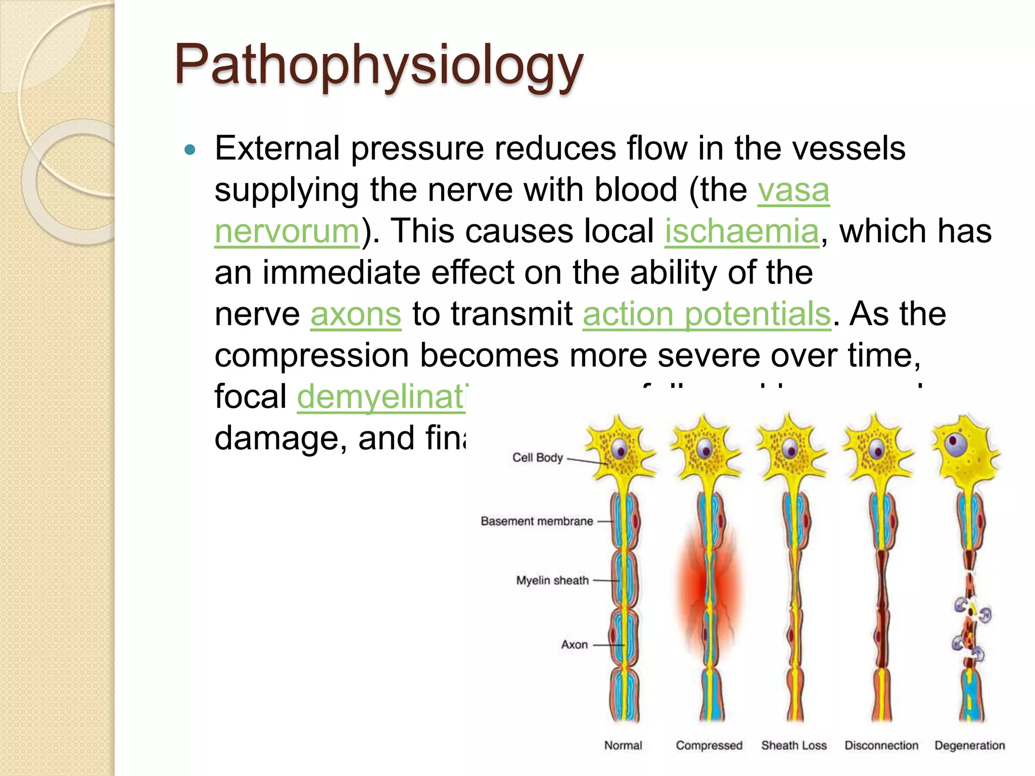 Peripheral Nerve compression syndrome | PPTX