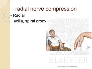 Peripheral Nerve compression syndrome | PPTX