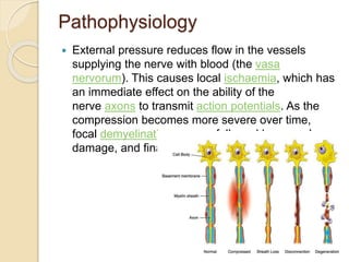 Peripheral Nerve compression syndrome | PPTX