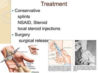 Peripheral Nerve compression syndrome | PPTX