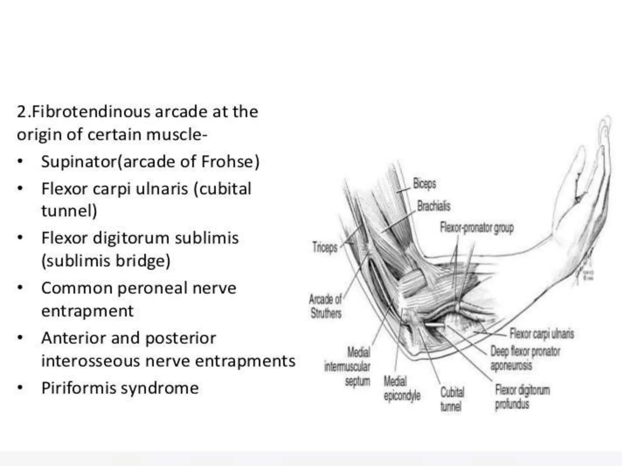 Nerve compression syndrome | PPTX