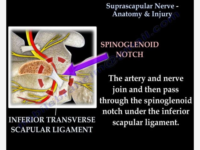 Nerve compression syndrome | PPTX