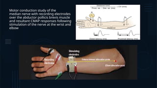 Nerve conduction studies for physiotherapy.pptx