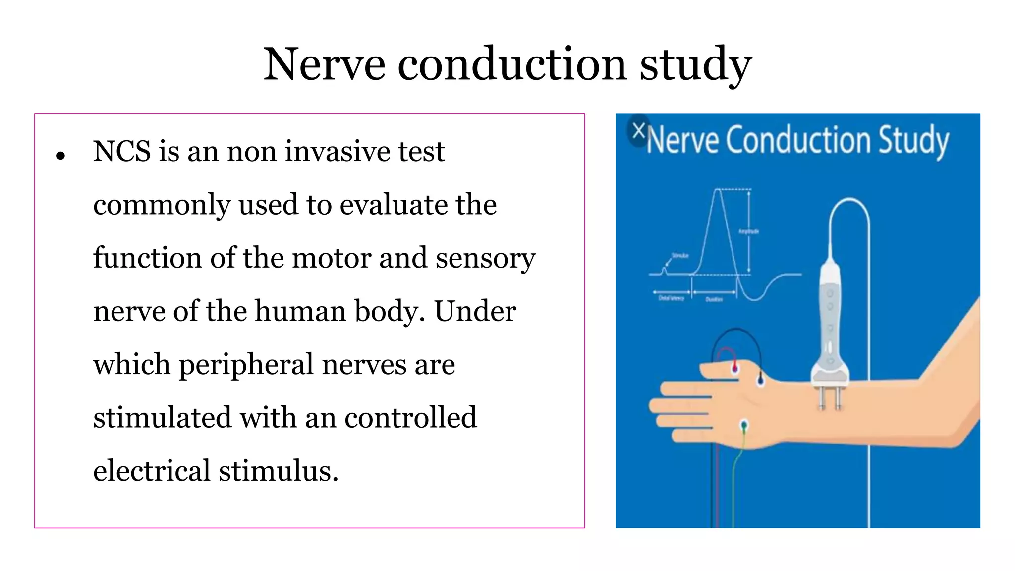 Nerve conduction study | PPTX