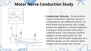 Nerve Conduction Study or NCS, Motor Conduction Study, Sensory Conduction Study, F Wave, H ...