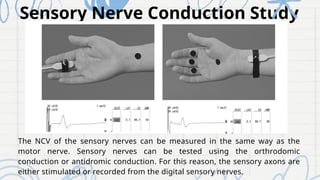 Nerve Conduction Study or NCS, Motor Conduction Study, Sensory ...