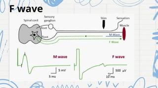 Nerve Conduction Study or NCS, Motor Conduction Study, Sensory Conduction Study, F Wave, H ...