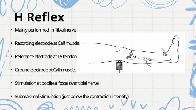 Nerve Conduction Study or NCS, Motor Conduction Study, Sensory Conduction Study, F Wave, H ...