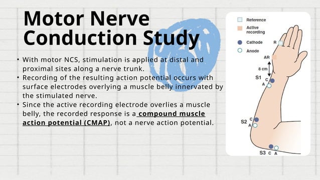 Nerve Conduction Study or NCS, Motor Conduction Study, Sensory ...