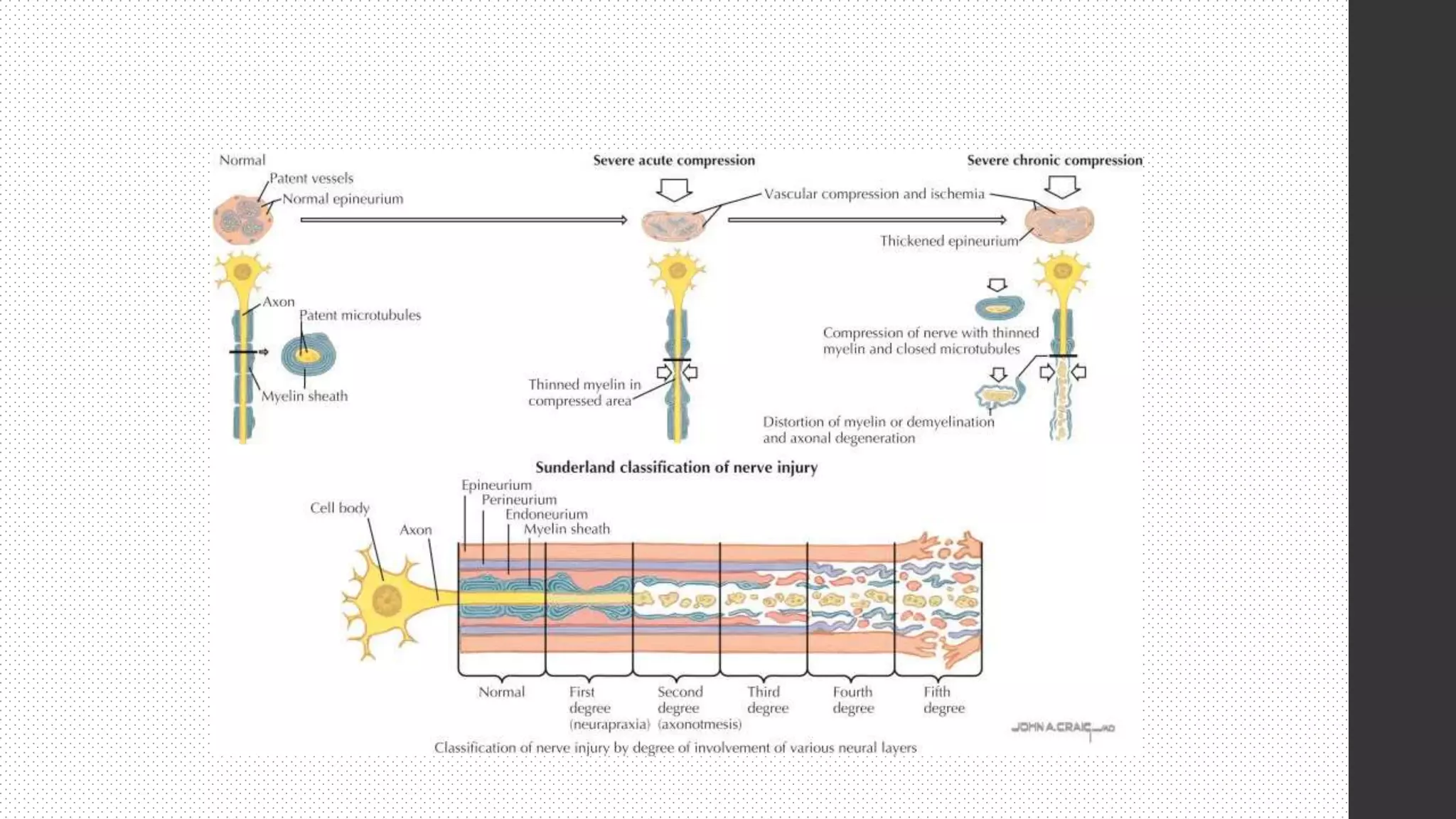 Nerve conduction study (ncs) | PPTX