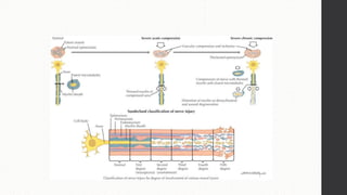 Nerve conduction study (ncs) | PPTX