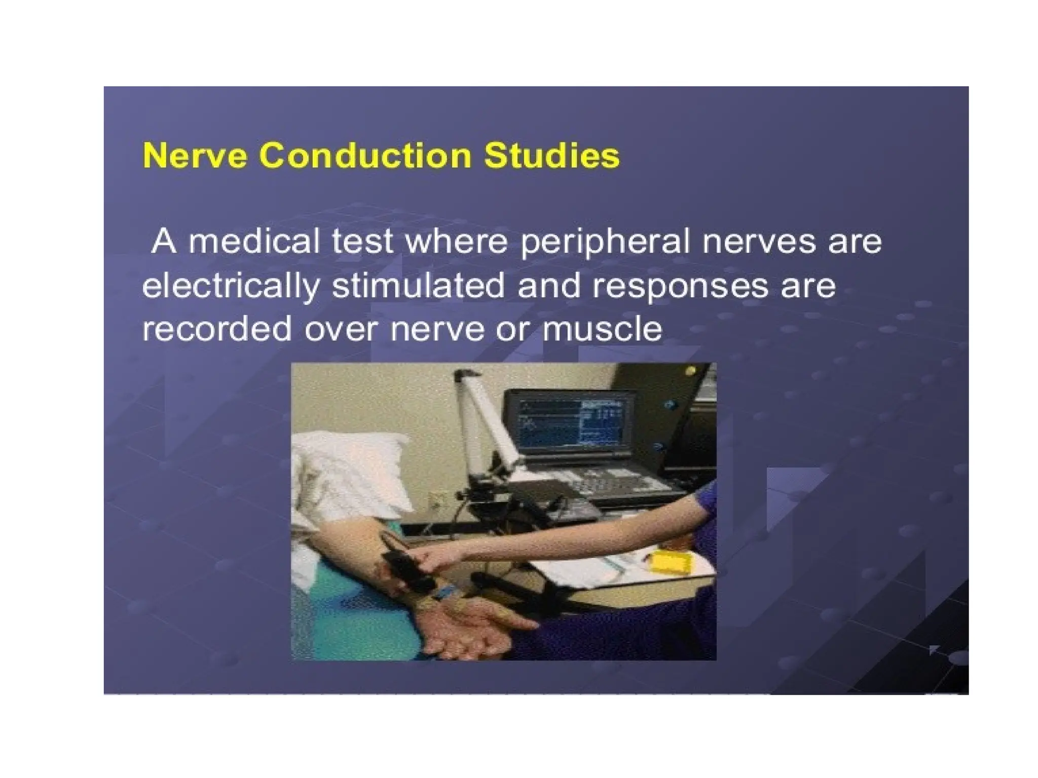 NERVE CONDUCTION VELOCITY physiotherapy (2)-1.pptx