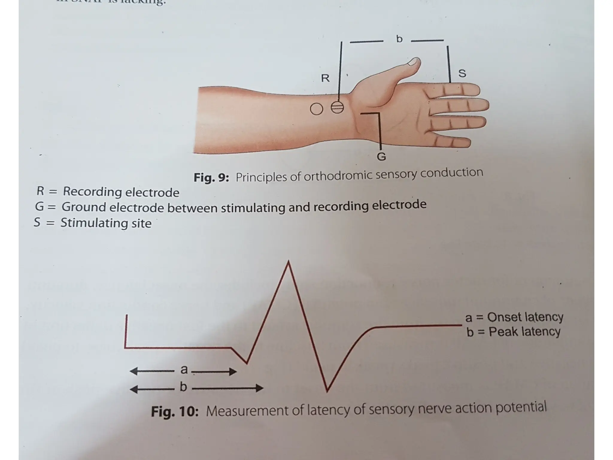 NERVE CONDUCTION VELOCITY physiotherapy (2)-1.pptx
