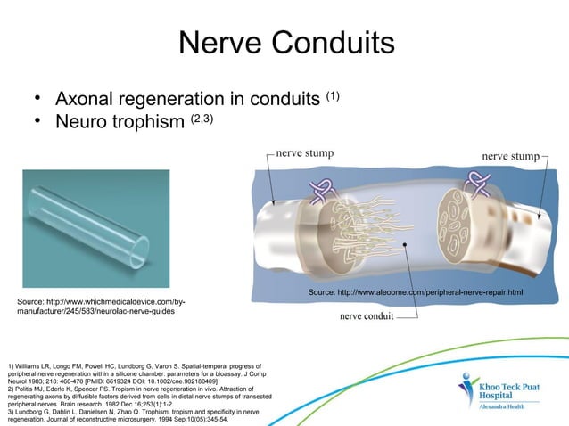 Nerve connector | PPT