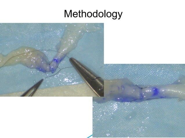 Nerve connector | PPT