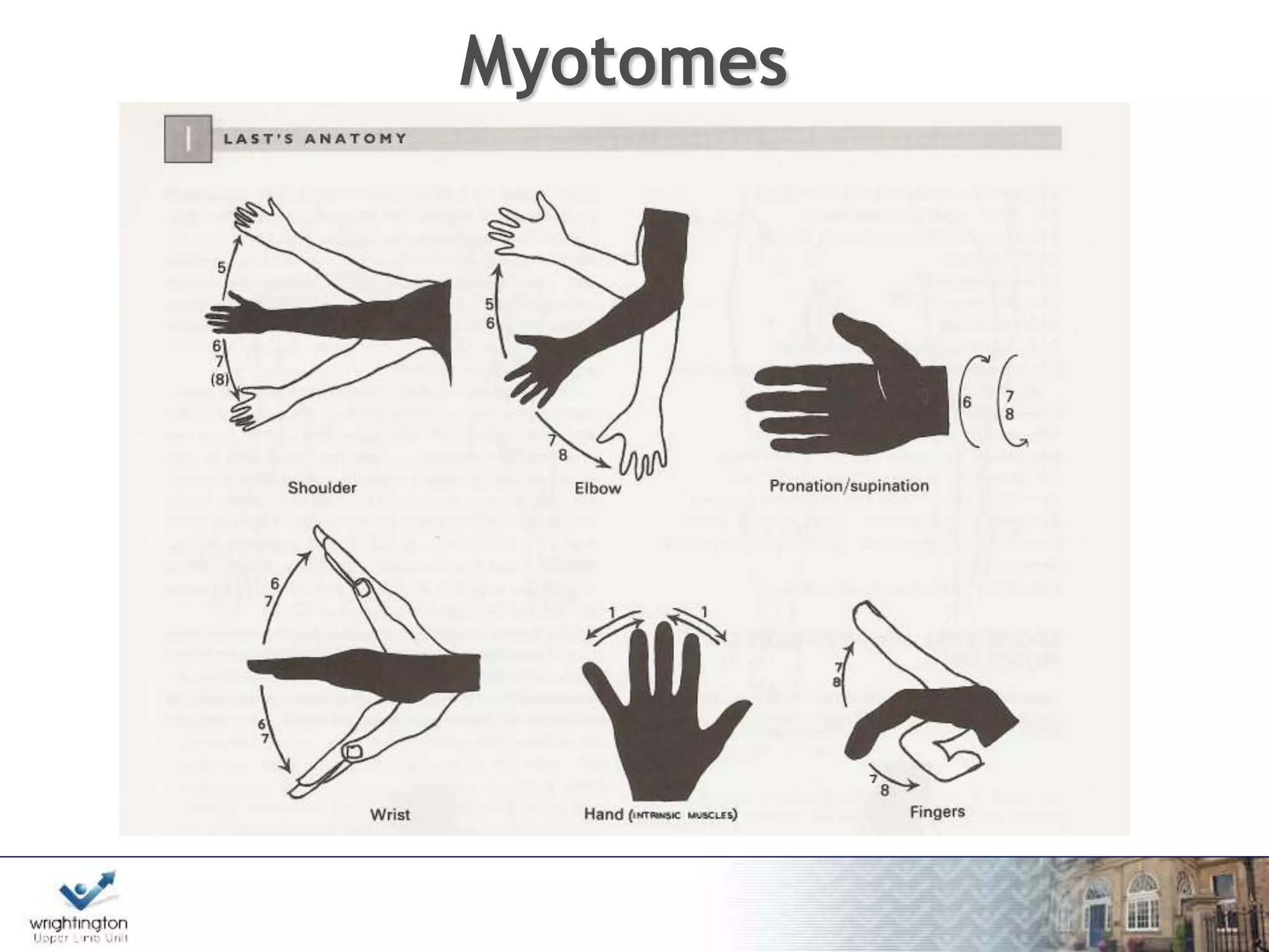 British & European Hand Diploma Revision - Nerve disorders | PPTX