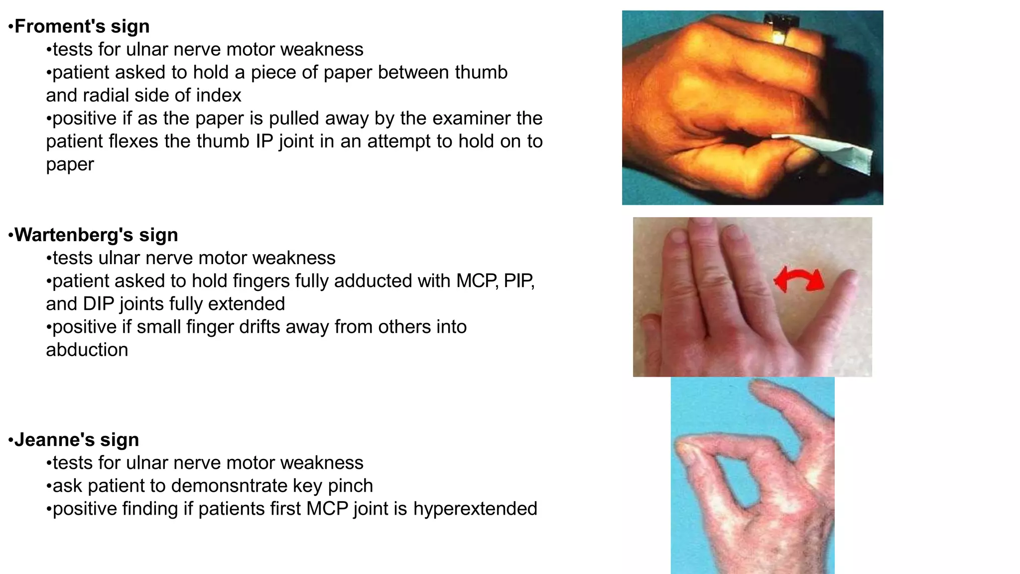 Nerve examination (upper limb and hands) | PPTX