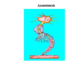 Nerve fibre final ...