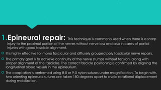 Nerve Grafting Principles , nerve repair by grafting | PPTX