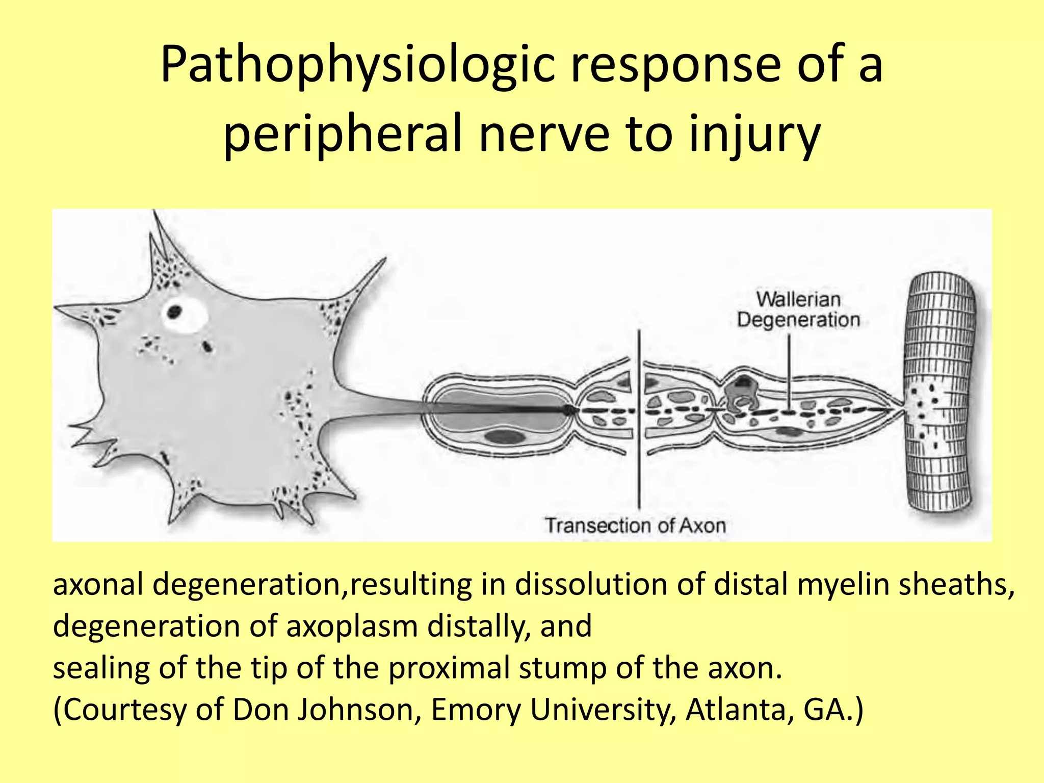 Nerve injuries during impaction surgeries | PPTX