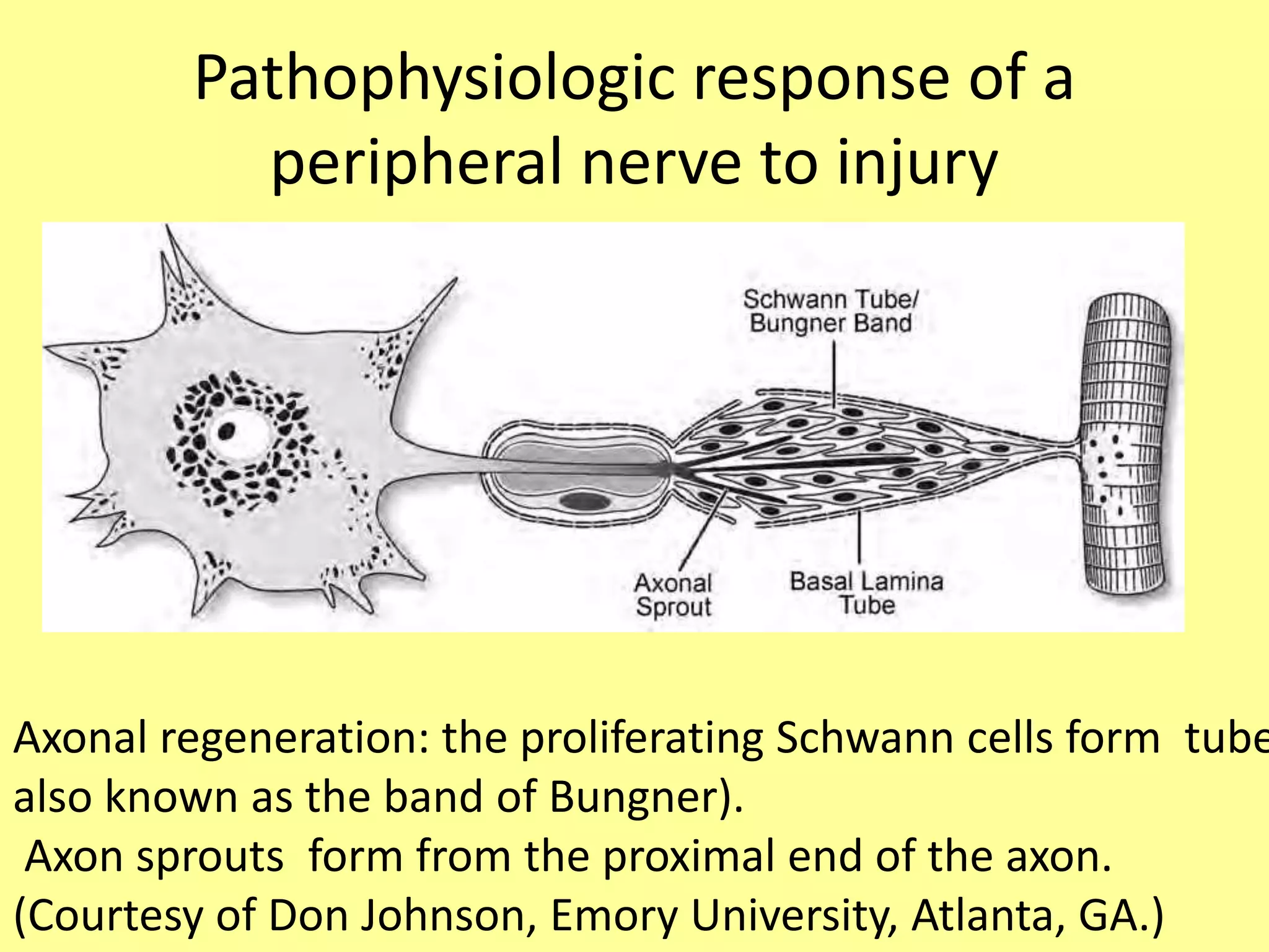 Nerve injuries during impaction surgeries | PPTX